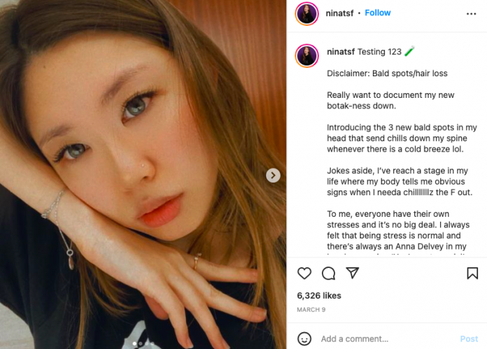 Former NOC actress and producer Nina Tan shares ‘disheartening’ hair ...